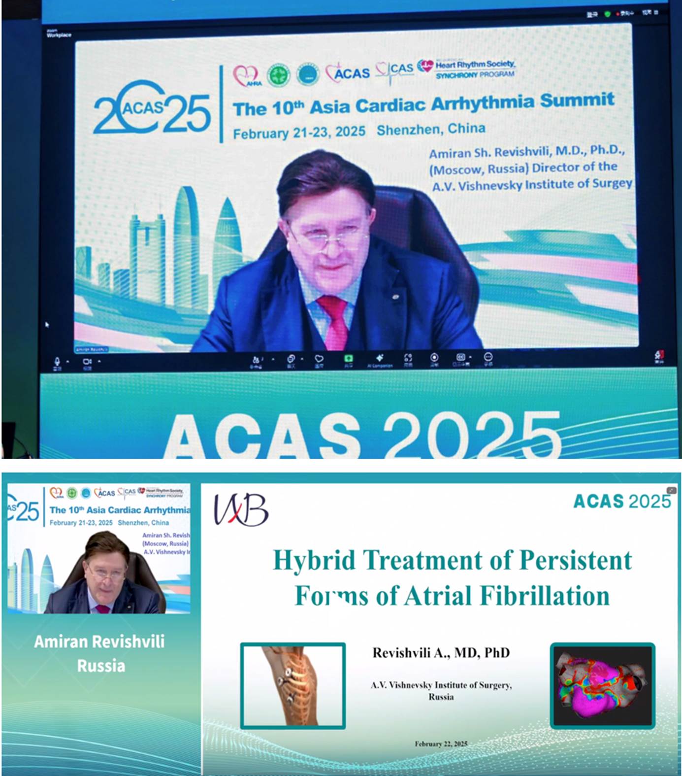 ACAS&CCAS 2025｜心律失常外科治疗论坛：回顾经典，共享联合_会议_亚洲心律学会